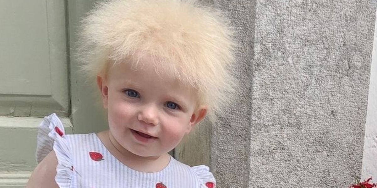 I capelli indomabili di Layla Davis. solo 100 hanno l'UHS | Roba da Donne