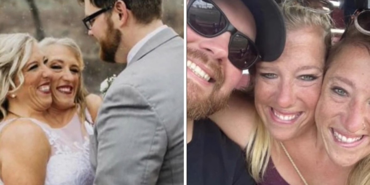 Gemelle siamesi, Abby Hensel ha sposato Josh Bowling | RDD