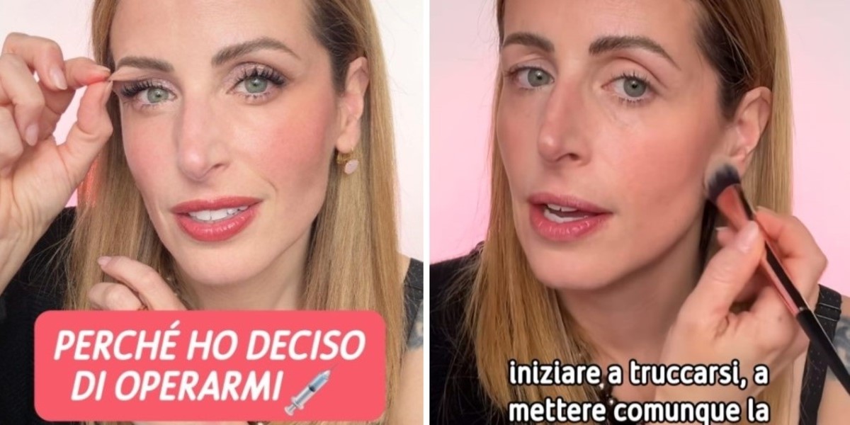Clio MakeUp: 'Perché ho deciso di fare la blefaroplastica' | RDD