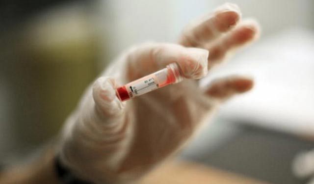 Piastrine basse: sintomi, cause e rimedi | Roba da Donne