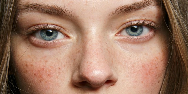 Efelidi: come valorizzarle o nasconderle | Roba da Donne