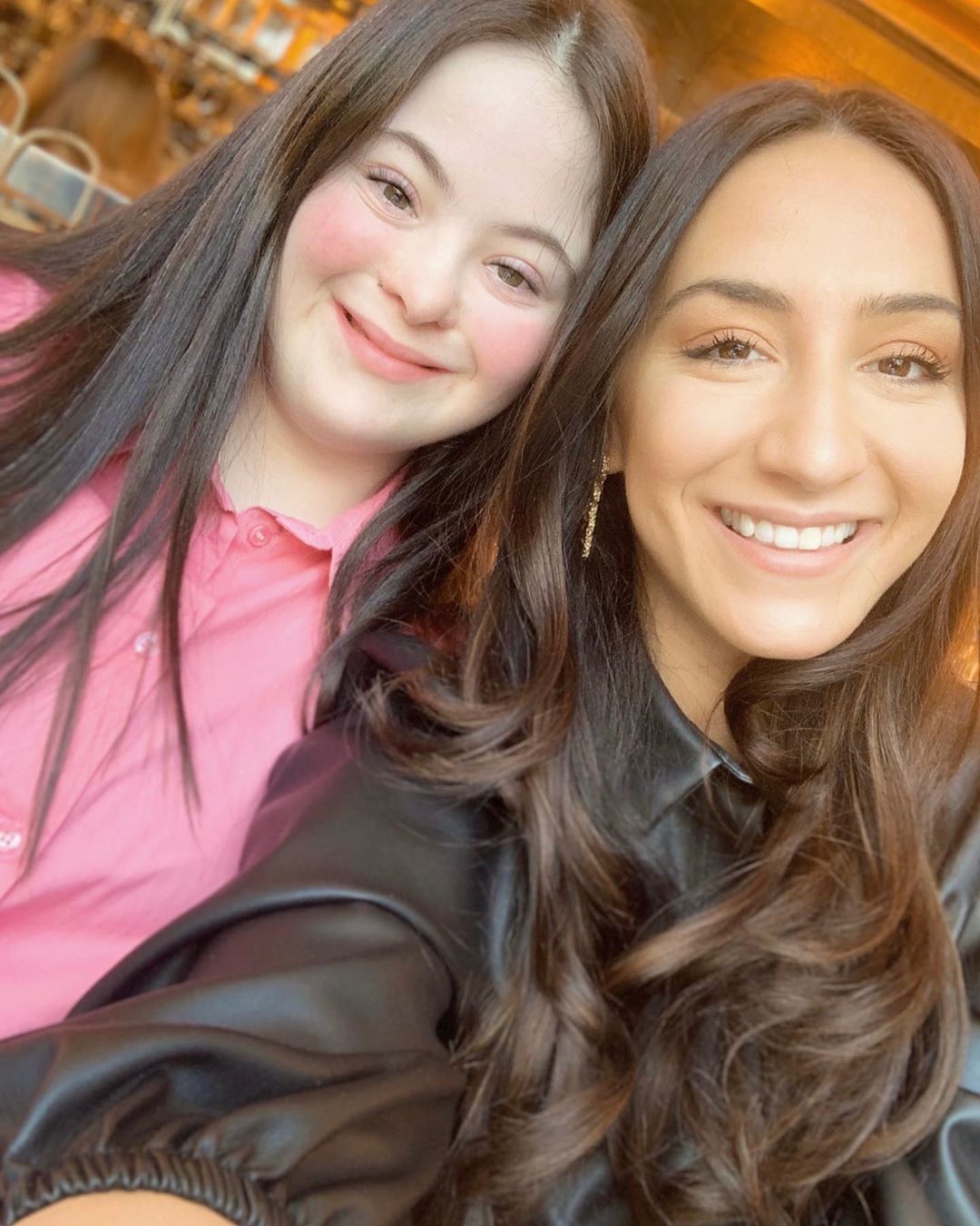 Ellie Goldstein, chi è la modella con Sindrome di Down per Gucci