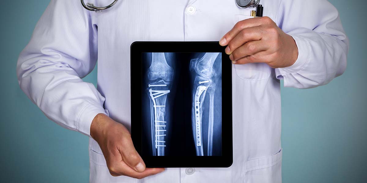 Allungamento delle gambe: perché è in aumento? | Roba da Donne